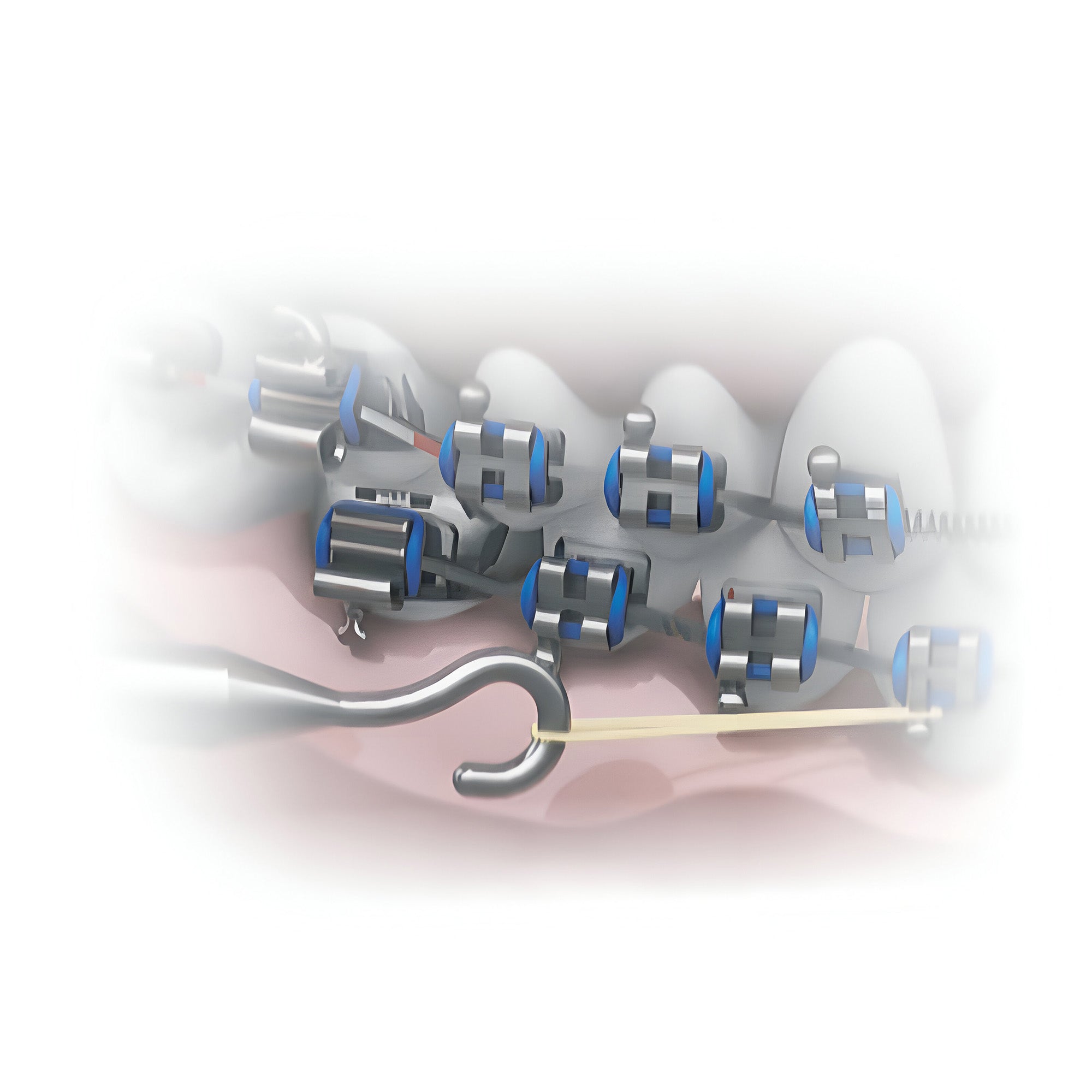 Morelli Dontrix Gauge – orthobuy